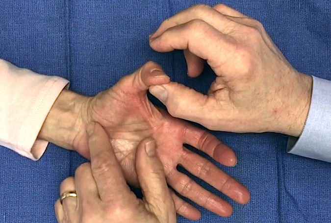Muscle Testing By Nerve Hand Surgery Resource